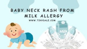Baby Neck Rash From Milk Allergy: Signs, Diagnosis & Remedies